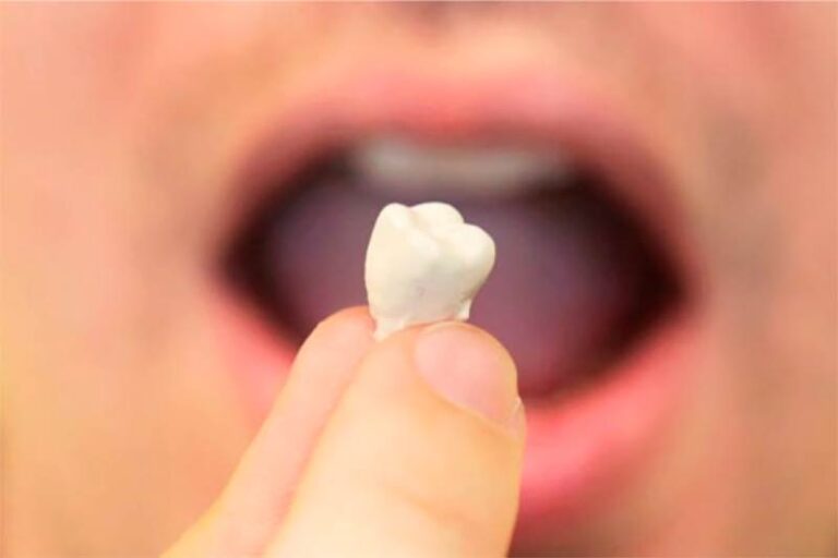Anatomía y morfología del diente - Clinica Dental Vallecas